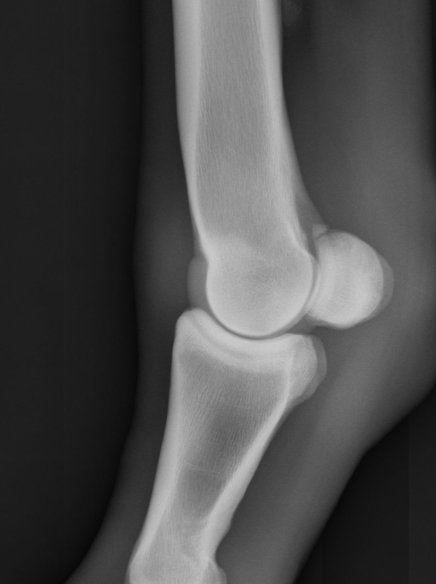 Sesamoid Fractures In Horse: Understanding Diagnosis, Treatment, and ...